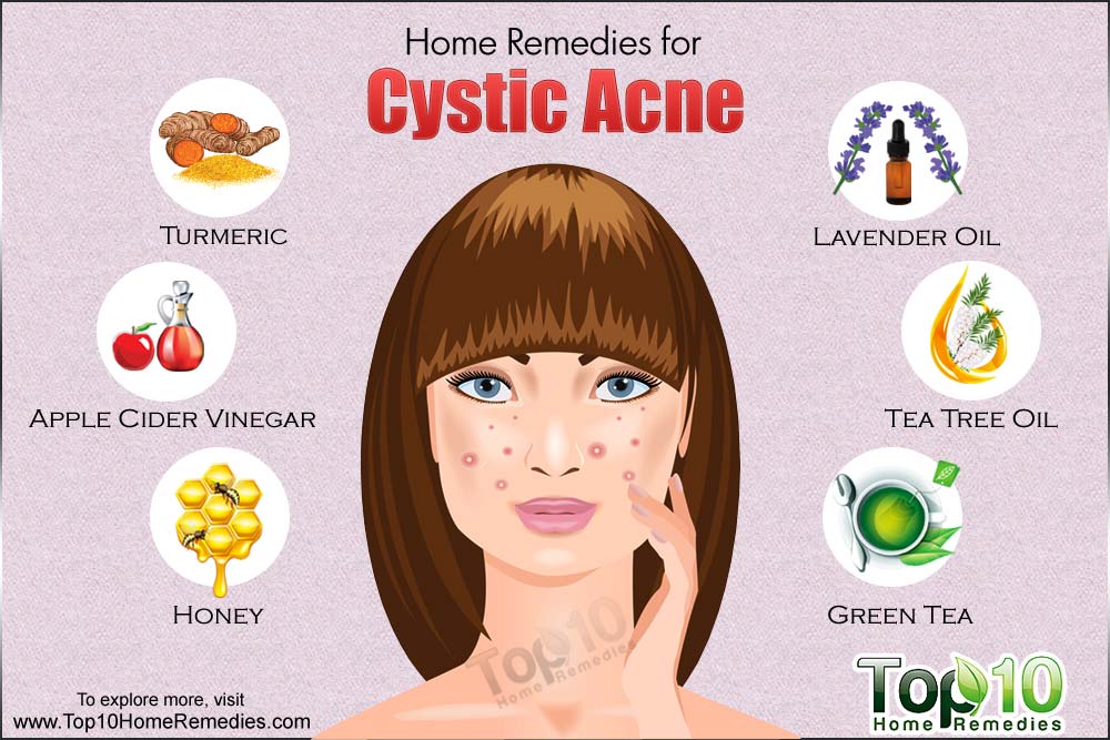 Home Remedies To Get Rid Of Lice Home Remedies Cystic Acne Home Remedies To Get Rid Of Lice Home Remedies Cystic Acne