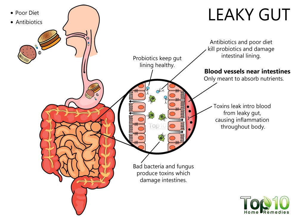 Risk Factors For Leaky Gut Syndrome You Should Know Top 10 Home Remedies Risk Factors For Leaky Gut Syndrome You Should Know Top 10 Home Remedies