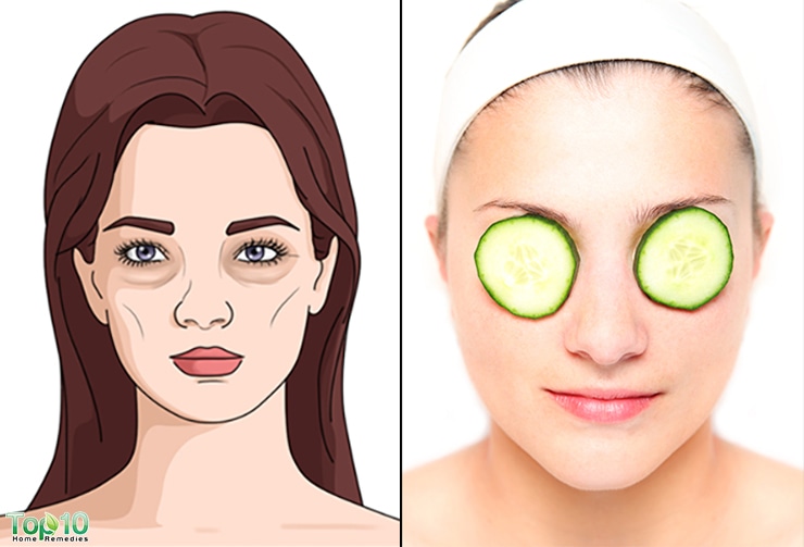 How To Get Rid Of Dark Circles as Fast as Possible | Top 10 Home Remedies