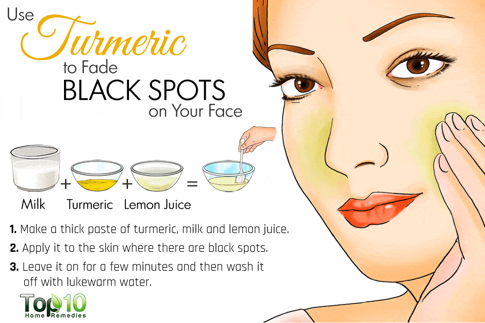 10 Home Remedies To Get Rid Of Dark Spots On Face Top 10 Home Remedies