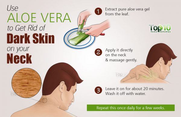 How to Get Rid of Dark Skin on Your Neck | Top 10 Home Remedies