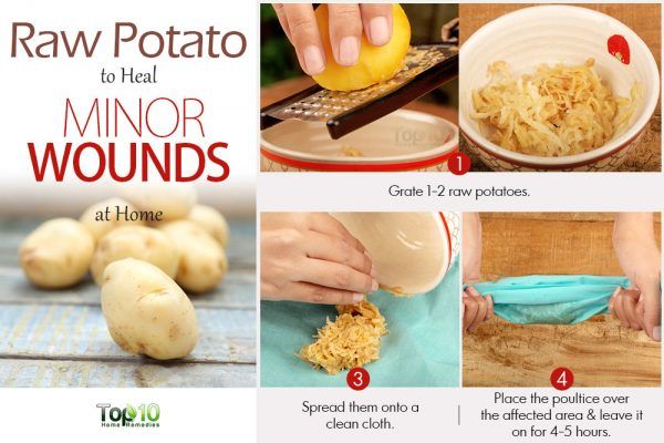 How to Heal Minor Wounds at Home - Page 2 of 3 | Top 10 Home Remedies