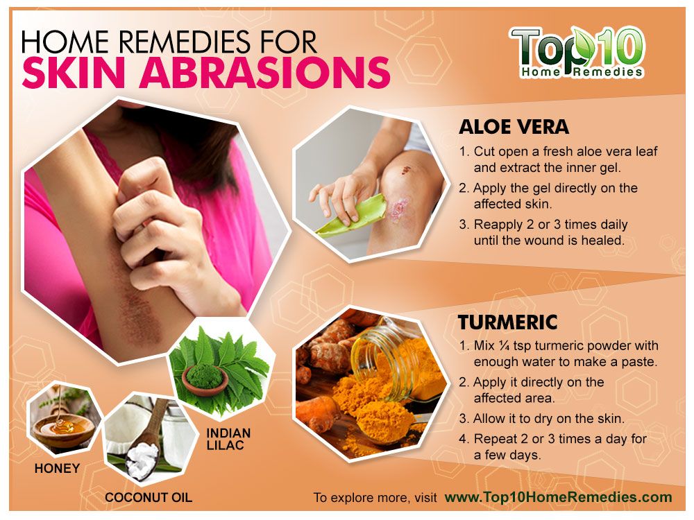 Home Remedies For Skin Abrasions Top 10 Home Remedies