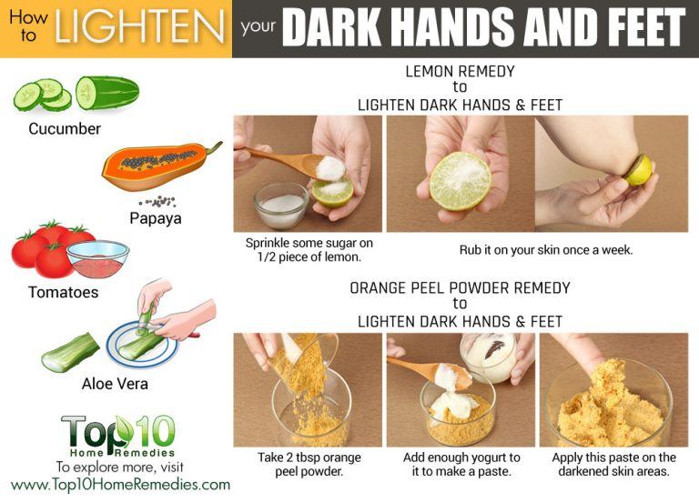 How to Lighten Your Dark Hands and Feet | Top 10 Home Remedies