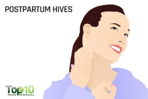 10 Common Postpartum Body Problems and How to Deal With Them | Top 10 ...