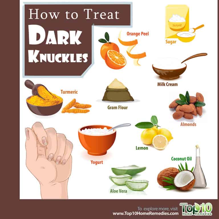 How to Treat Dark Knuckles | Top 10 Home Remedies
